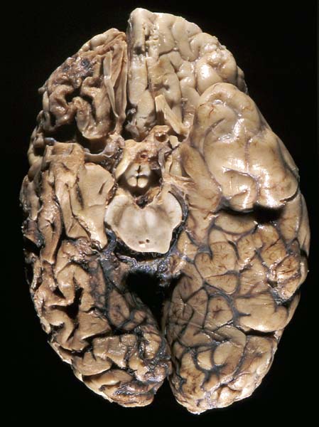 Sessions | NowYouKnow Neuro