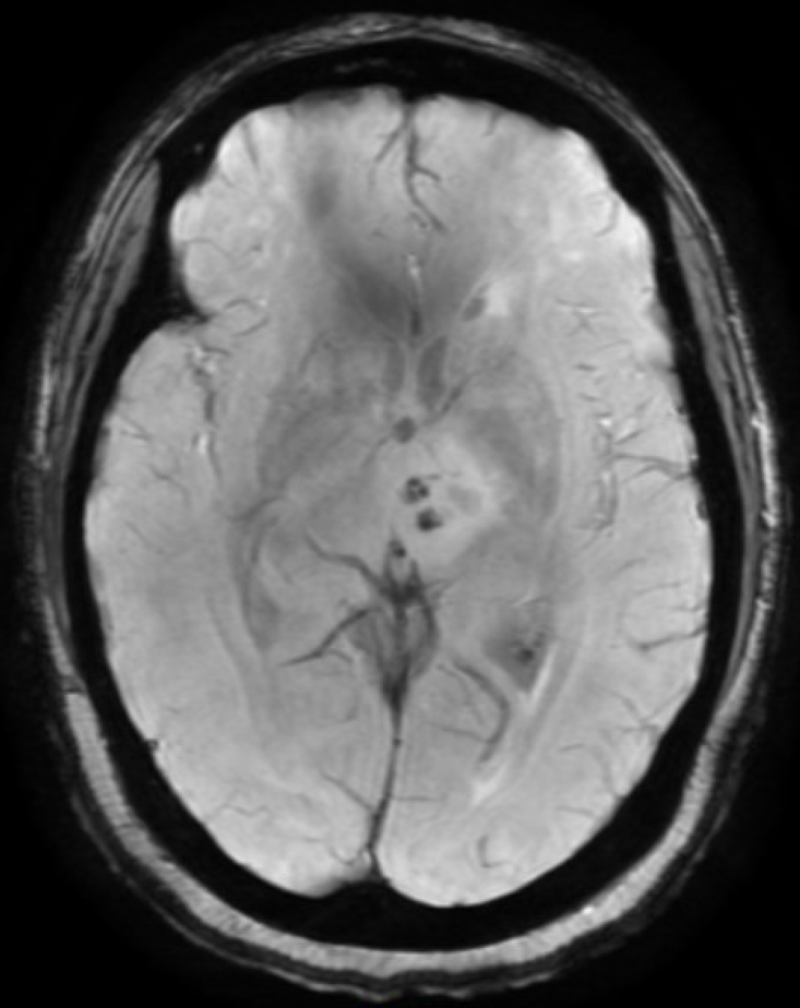 Sessions | NowYouKnow Neuro