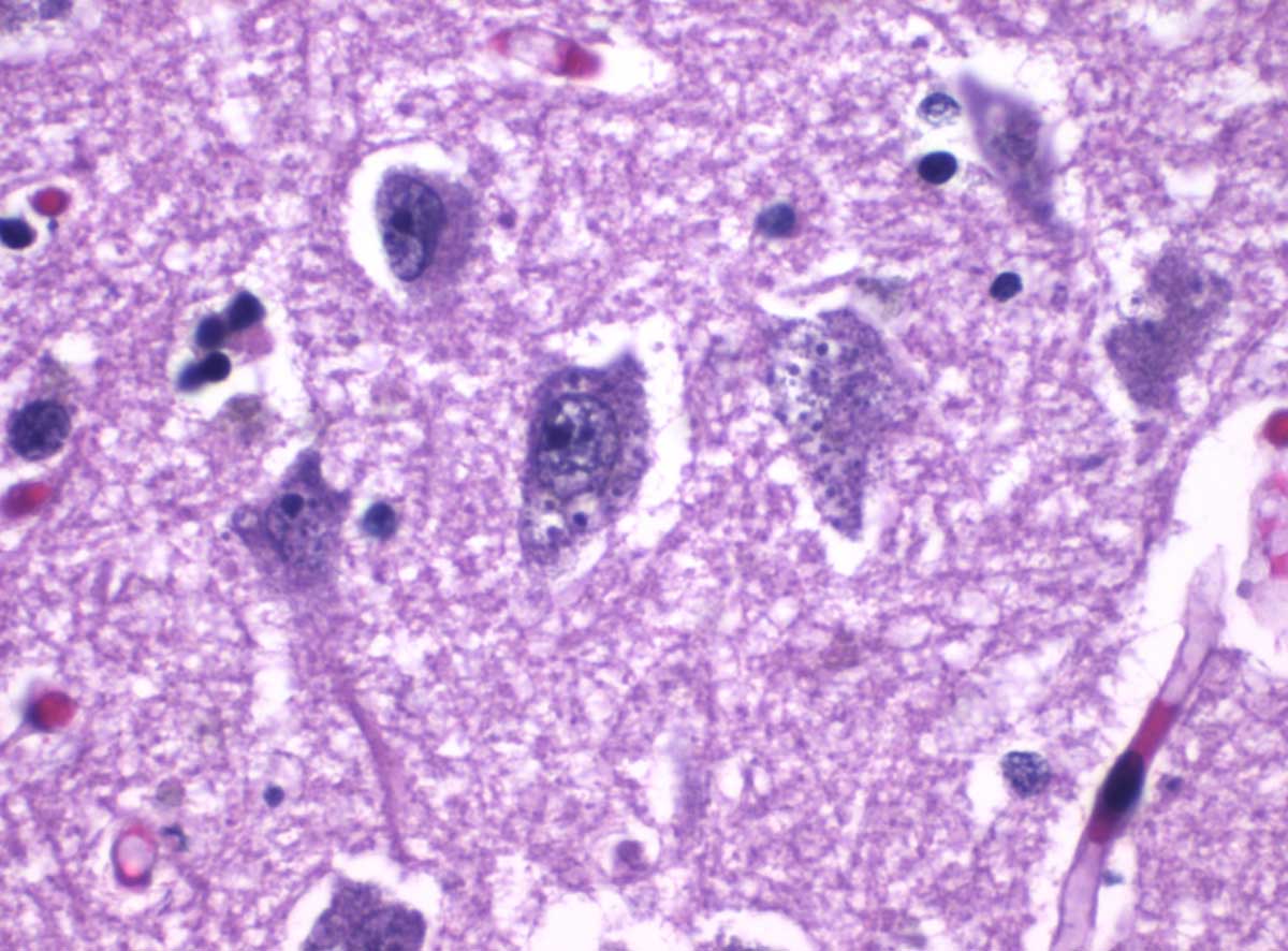 Sessions | NowYouKnow Neuro