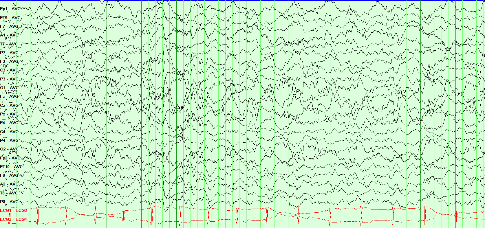 Sleep | NowYouKnow Neuro