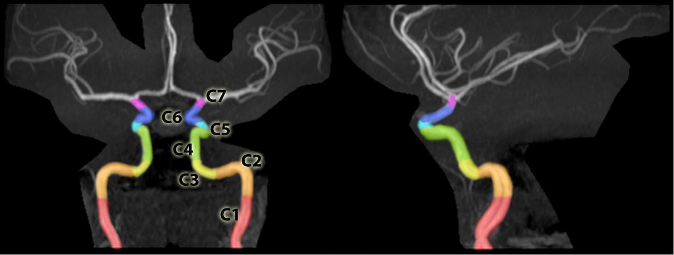 Vascular Anatomy of the Brain Review | NowYouKnow Neuro