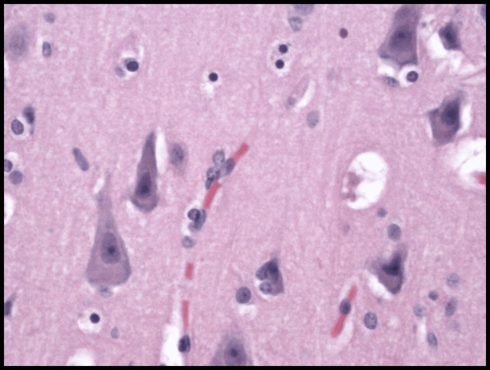 Basic Neuroanatomy | NowYouKnow Neuro