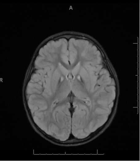 Toxicology & Metabolic Disease Review and Quiz | NowYouKnow Neuro