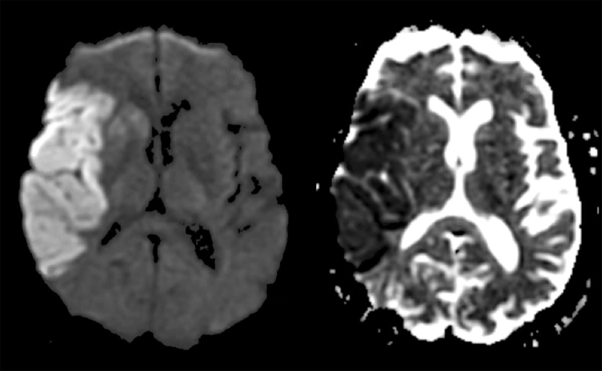 Vascular Anatomy | NowYouKnow Neuro