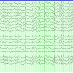 Learn to Read EEG , with practice questions! | NowYouKnow Neuro