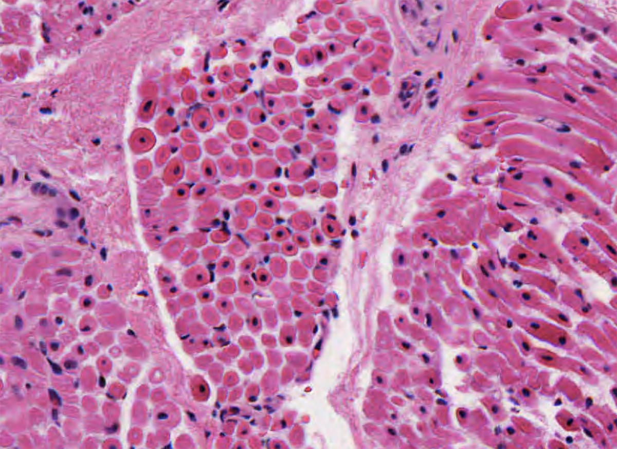 Muscle Pathology Review w/ Images and Quiz! | NowYouKnow Neuro