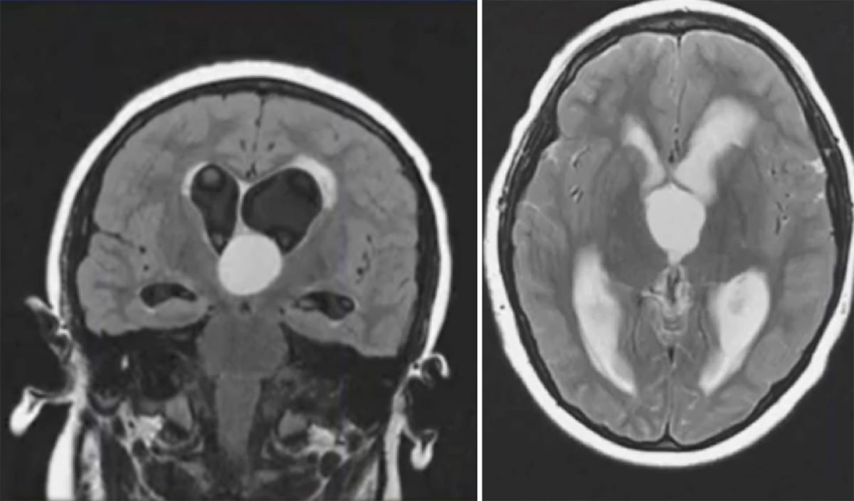 High Yield Neuroradiology - Over 200 Images! | NowYouKnow Neuro