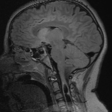 Spinal Cord | Chapter and Practice Questions | NowYouKnow Neuro
