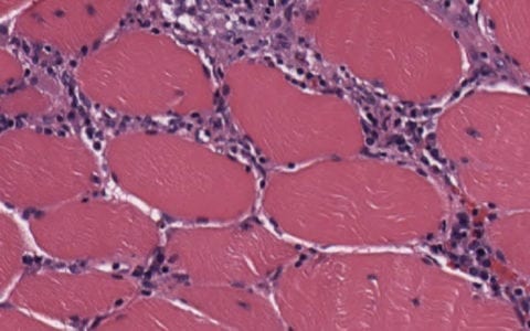Neurology Review for RITE, Board, & Shelf Exams | NowYouKnow Neuro