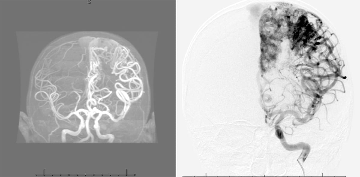 Vascular Neurology | Review and Quiz | NowYouKnow Neuro