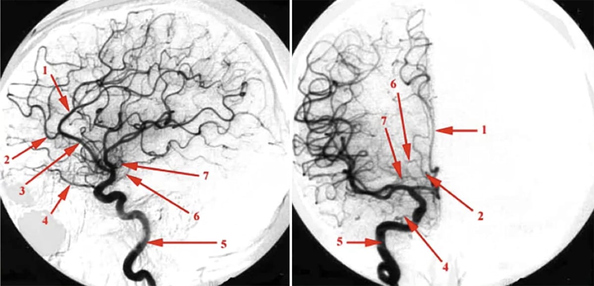 Vascular Anatomy | NowYouKnow Neuro
