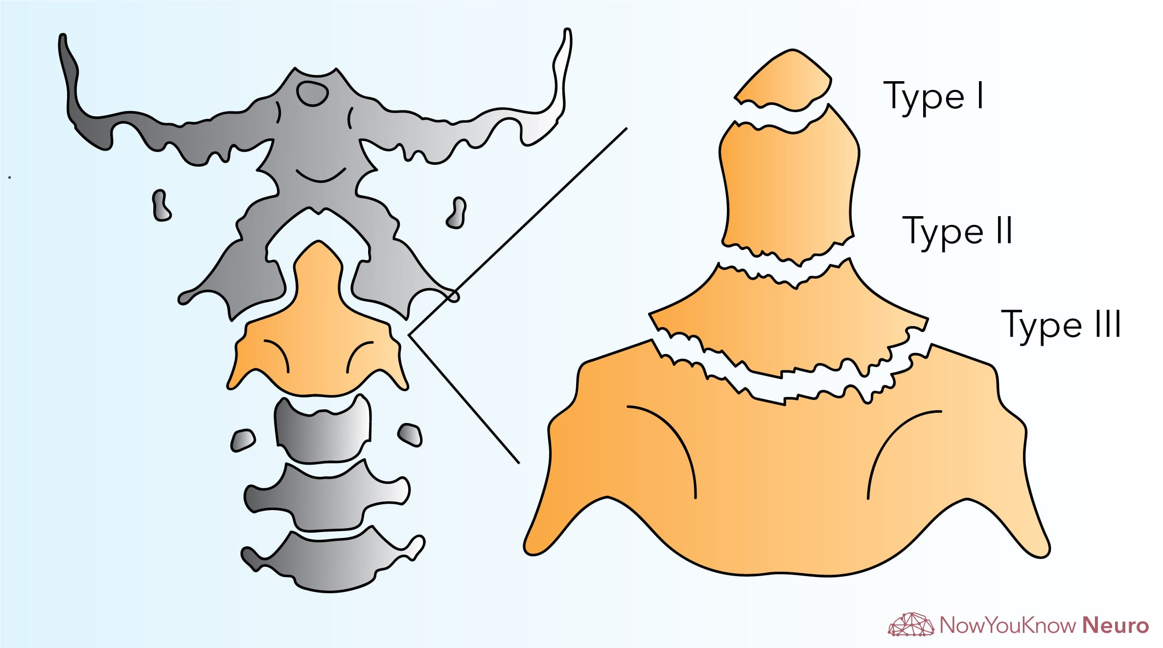 Spine & Cord | Chapter and Practice Questions | NowYouKnow Neuro