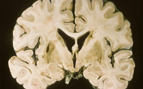 Neurology Review for RITE, Board, & Shelf Exams | NowYouKnow Neuro