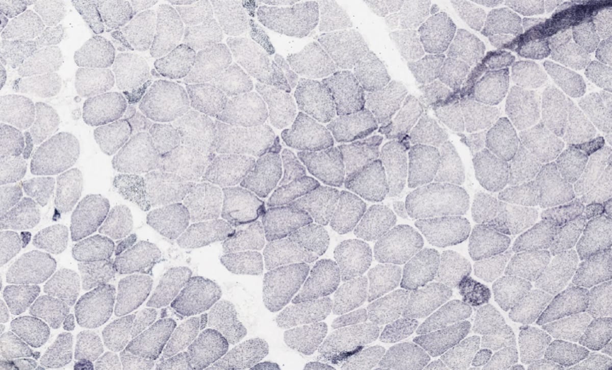 Muscle Pathology Review w/ Images and Quiz! | NowYouKnow Neuro