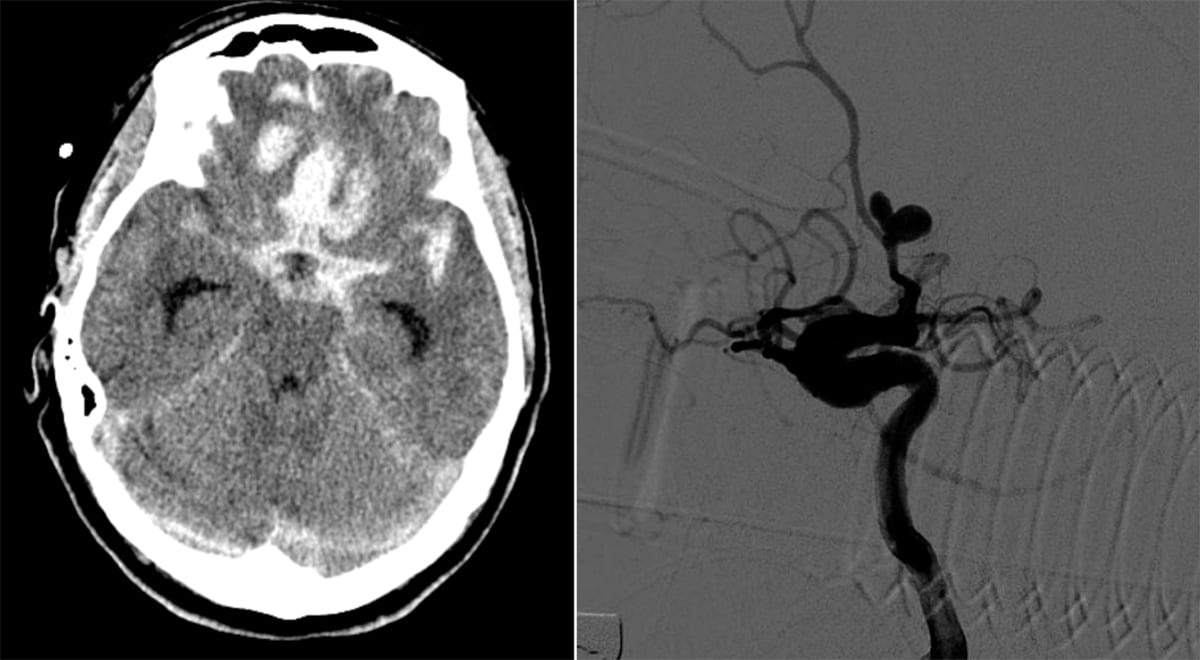 Headache Review | Chapter with Questions | NowYouKnow Neuro