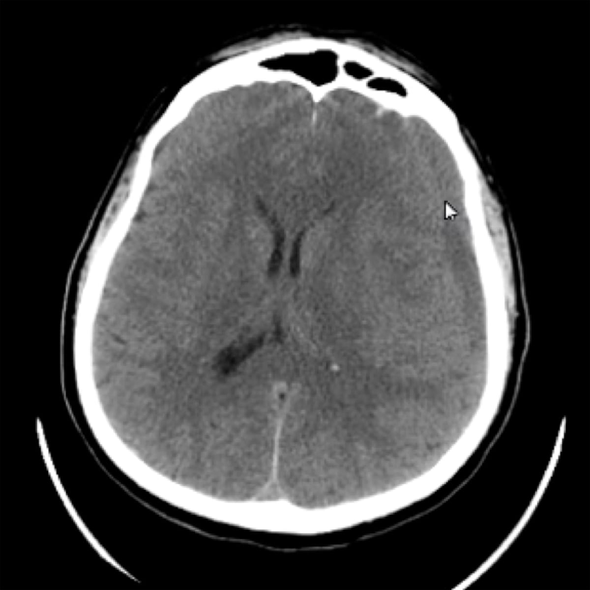 High Yield Neuroradiology - Over 200 Images! | NowYouKnow Neuro